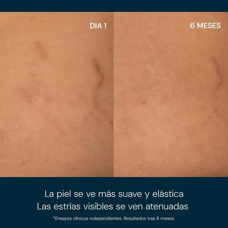 Elemis Aceite corporal reduce el aspecto de las estrías | Ulta Beauty MX